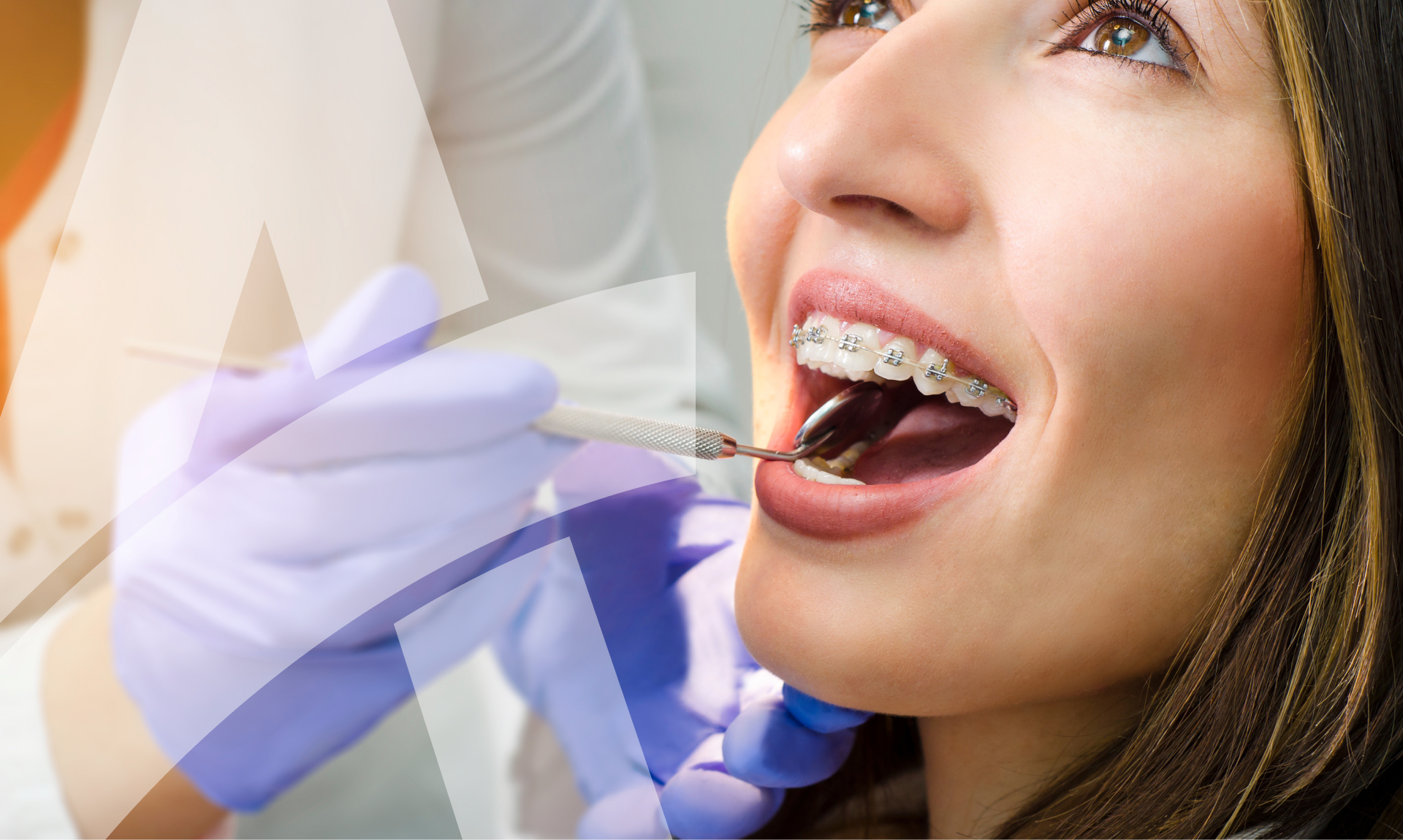 Orthodontic Treatment Options In Lahore: What You Need To Know - Dentoral