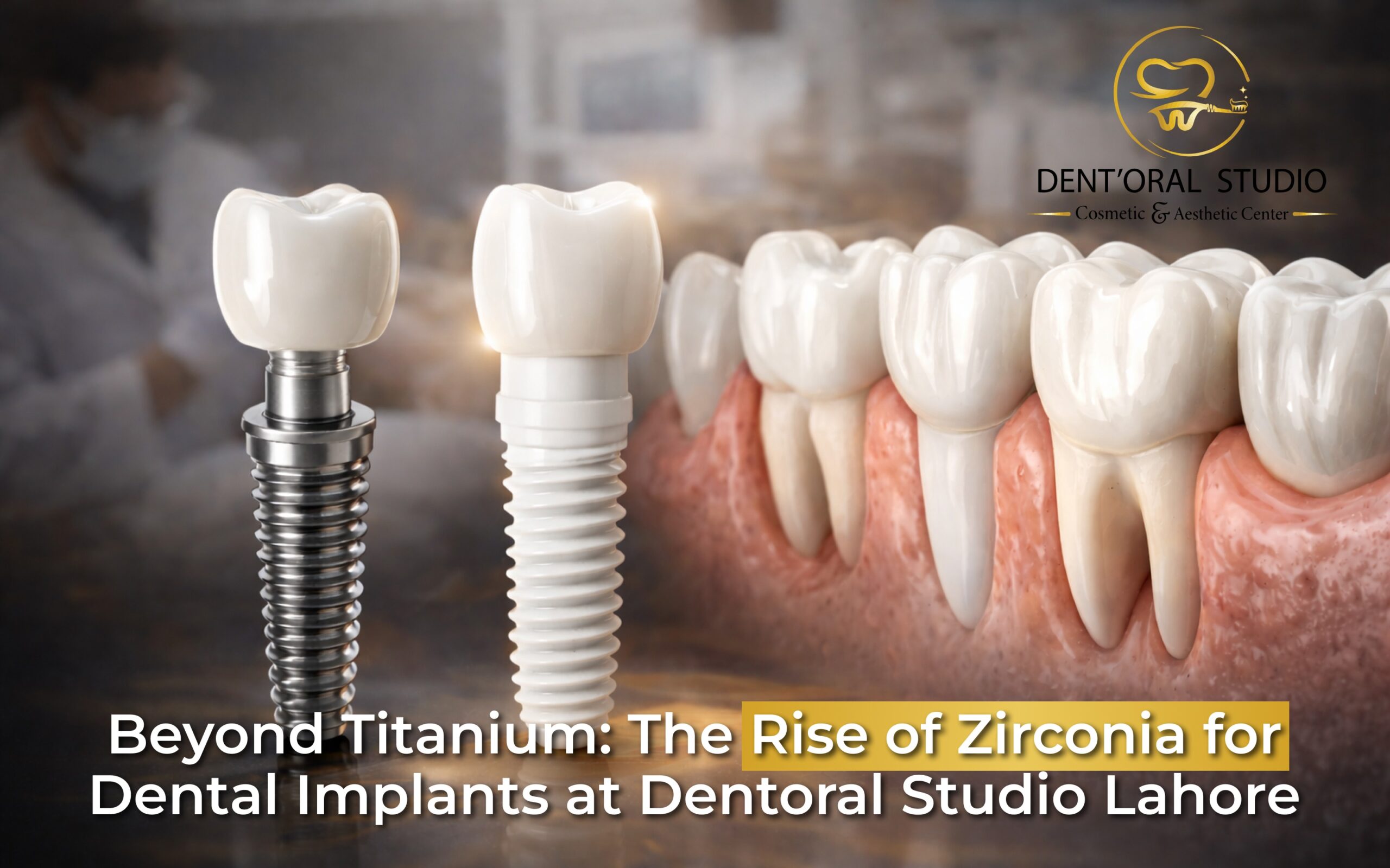 The Rise of Zirconia for Dental Implants at Dentoral Studio Lahore